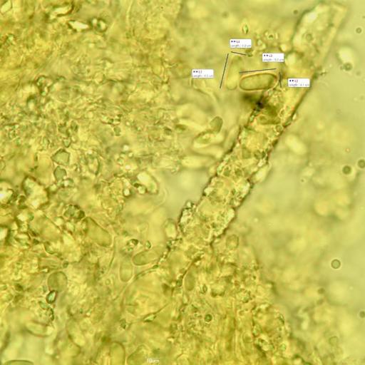 Devil's-fingers (Clathrus Archeri) Mushroom Identification, Habitat & Uses