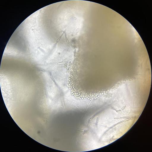 Tolypocladium Longisegmentatum Mushroom Identification, Habitat & Uses